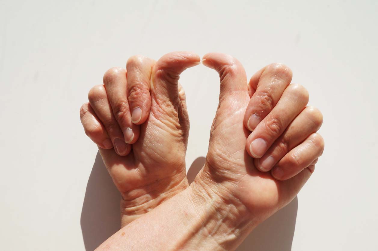 Ehlers Danlos National Foundation